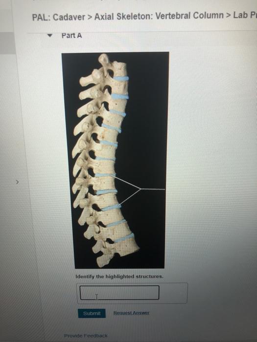 Solved PAL: Cadaver > Axial Skeleton: Vertebral Column > Lab | Chegg.com