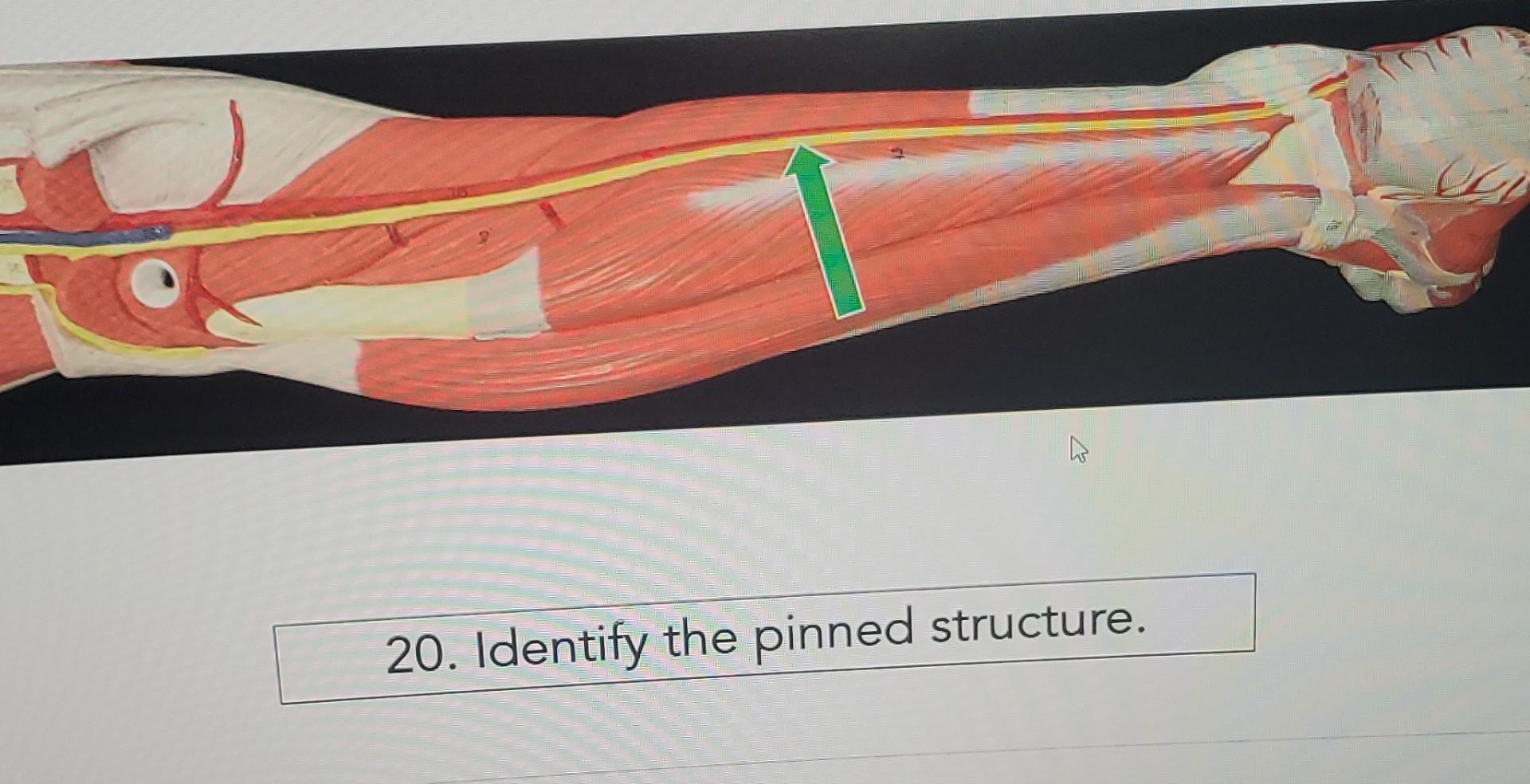 Solved 20. Identify the pinned structure. | Chegg.com