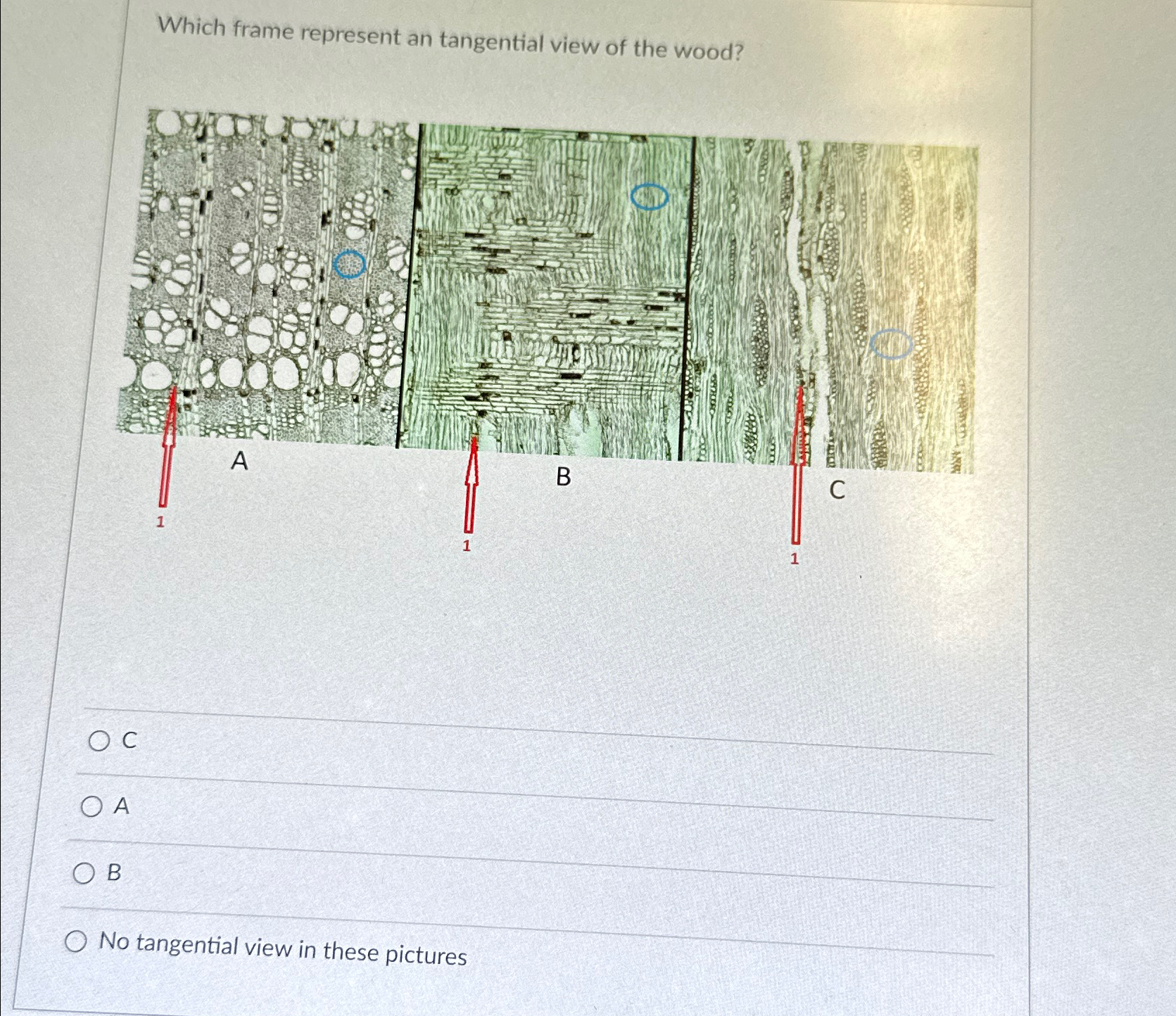 Solved Which frame represent an tangential view of the | Chegg.com
