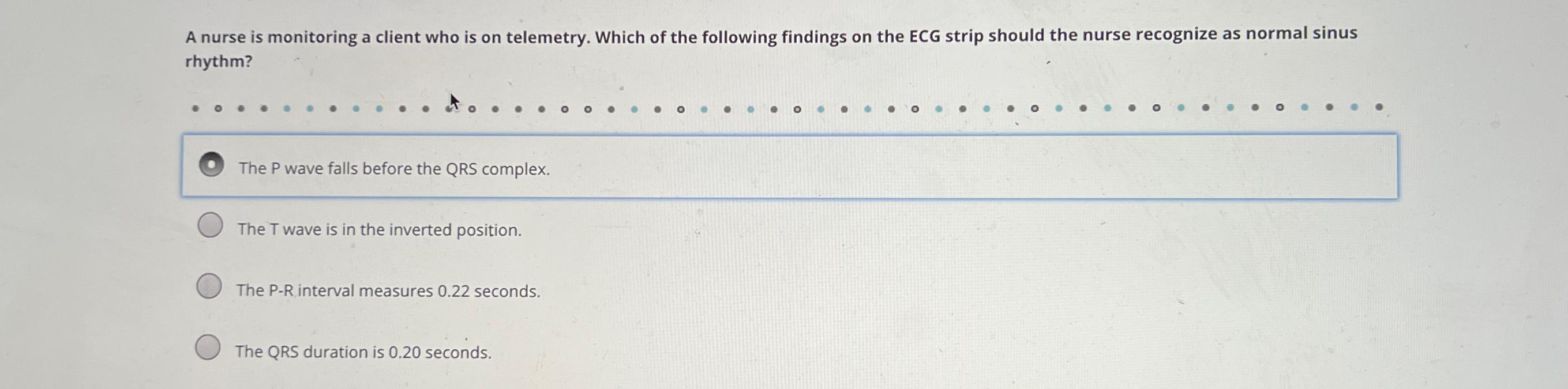 Solved A nurse is monitoring a client who is on telemetry. | Chegg.com