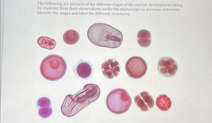 Solved The following are pictures of the different stages of | Chegg.com