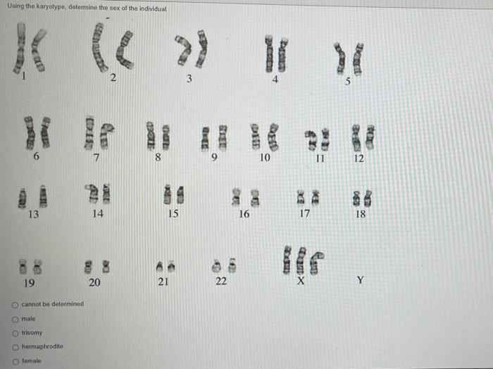 Solved Using The Karyotype Determine The Sex Of The 5580