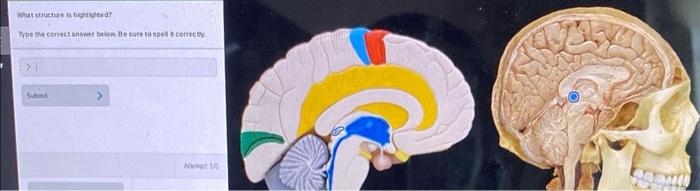 Solved What structue is hlerilowed d? Type the coriter | Chegg.com