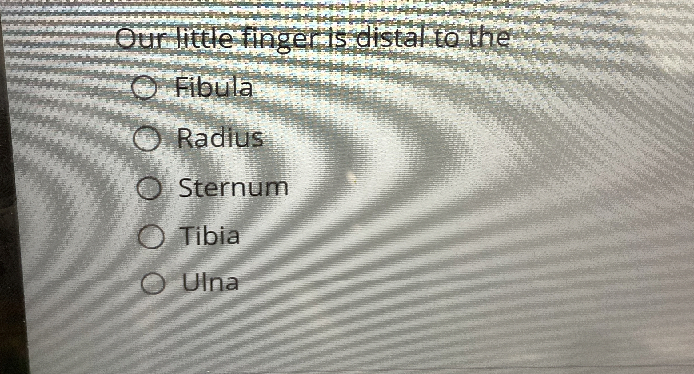 Our little finger is distal to | Chegg.com