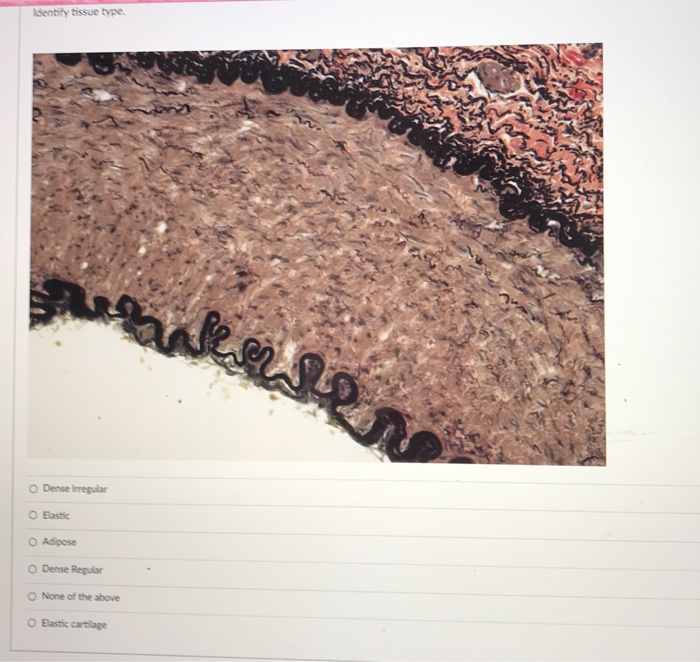 Solved Identify tissue type Dense Irregular Elastic Adipose | Chegg.com
