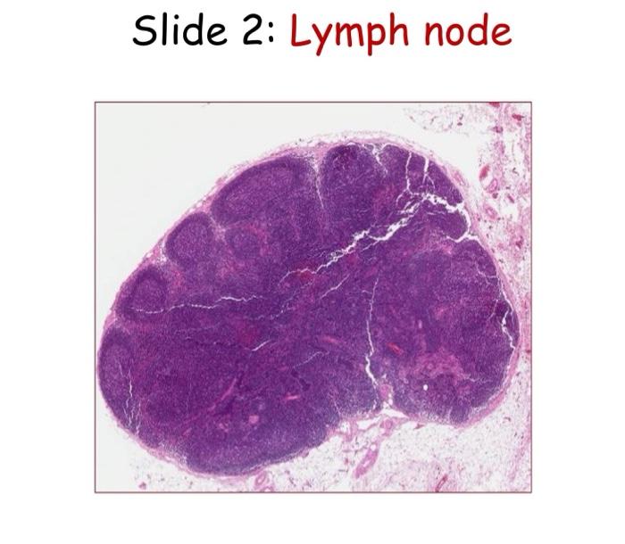 Slide 2: Lymph nodesketch & label the slide and make | Chegg.com