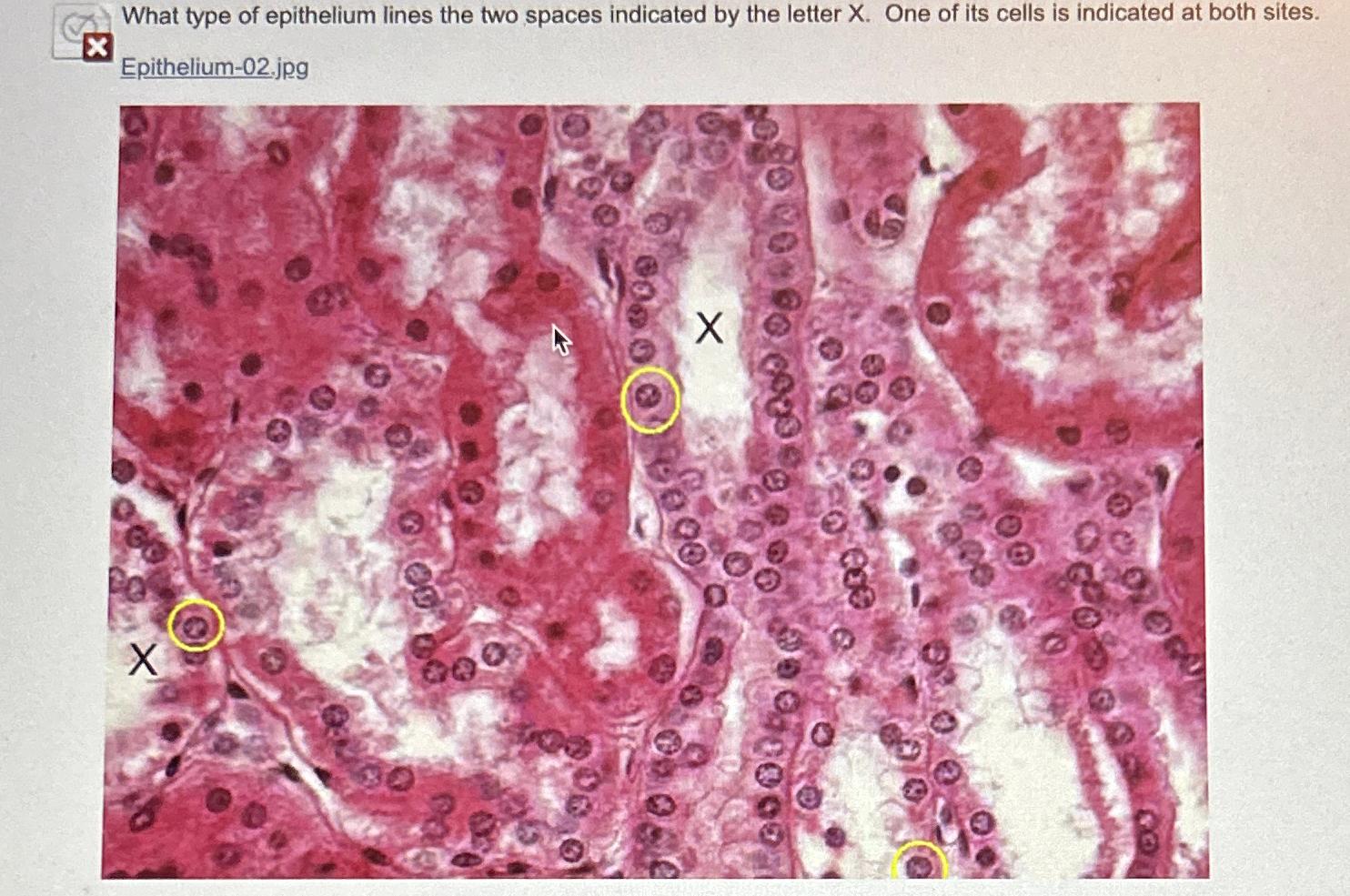 Solved What type of epithelium lines the two spaces | Chegg.com