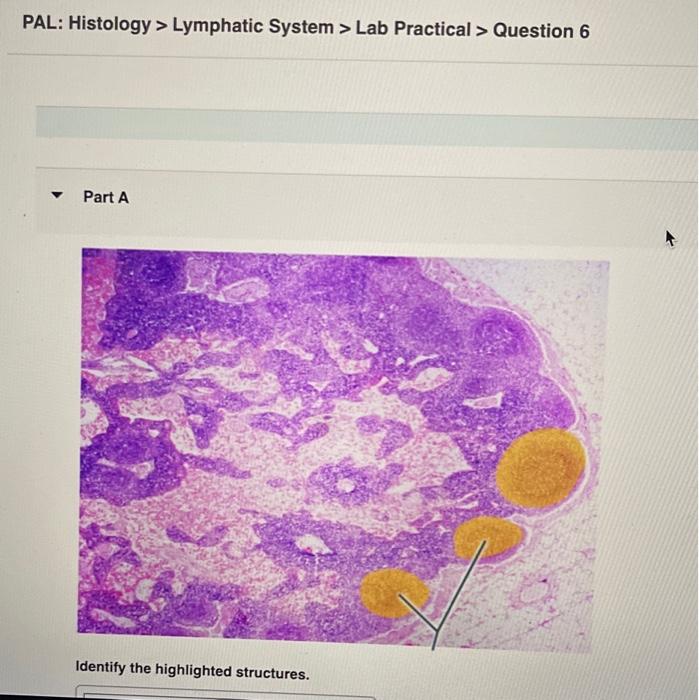 PAL: Histology > Lymphatic System > Lab Practical > | Chegg.com PAL: Histology > Lymphatic System > Lab Practical > | Chegg.com