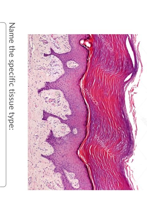 + 1. General tissue type: EPITHELIAL Specific tissue | Chegg.com