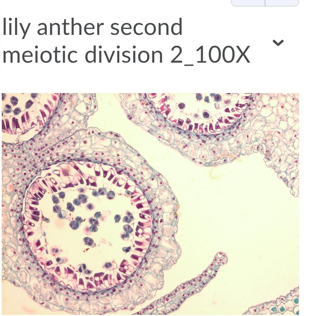 Solved lily ovulary two-nucleate stage_40X