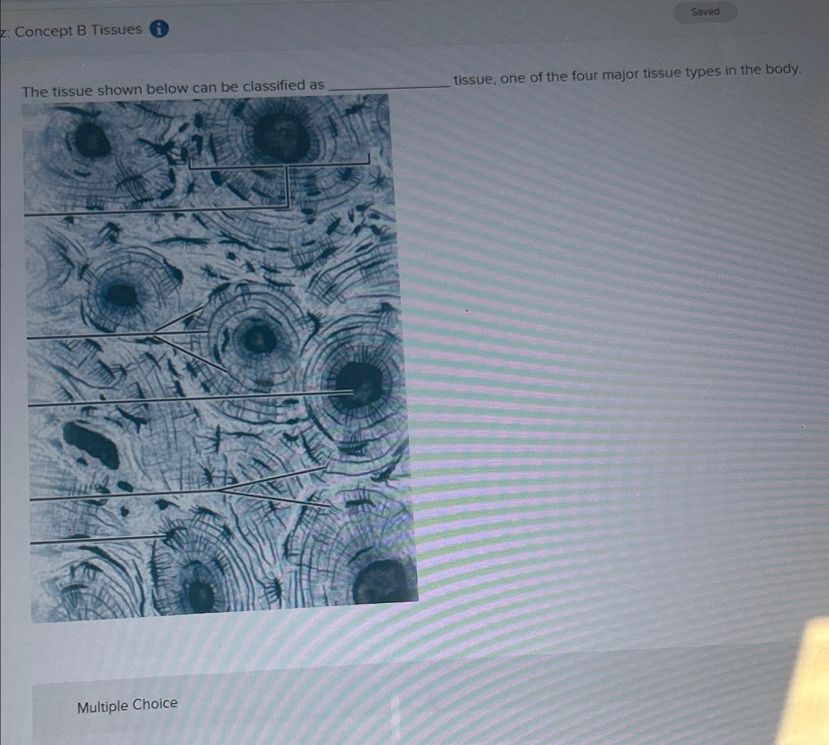 Solved Concept B TissuesThe tissue shown below can be | Chegg.com