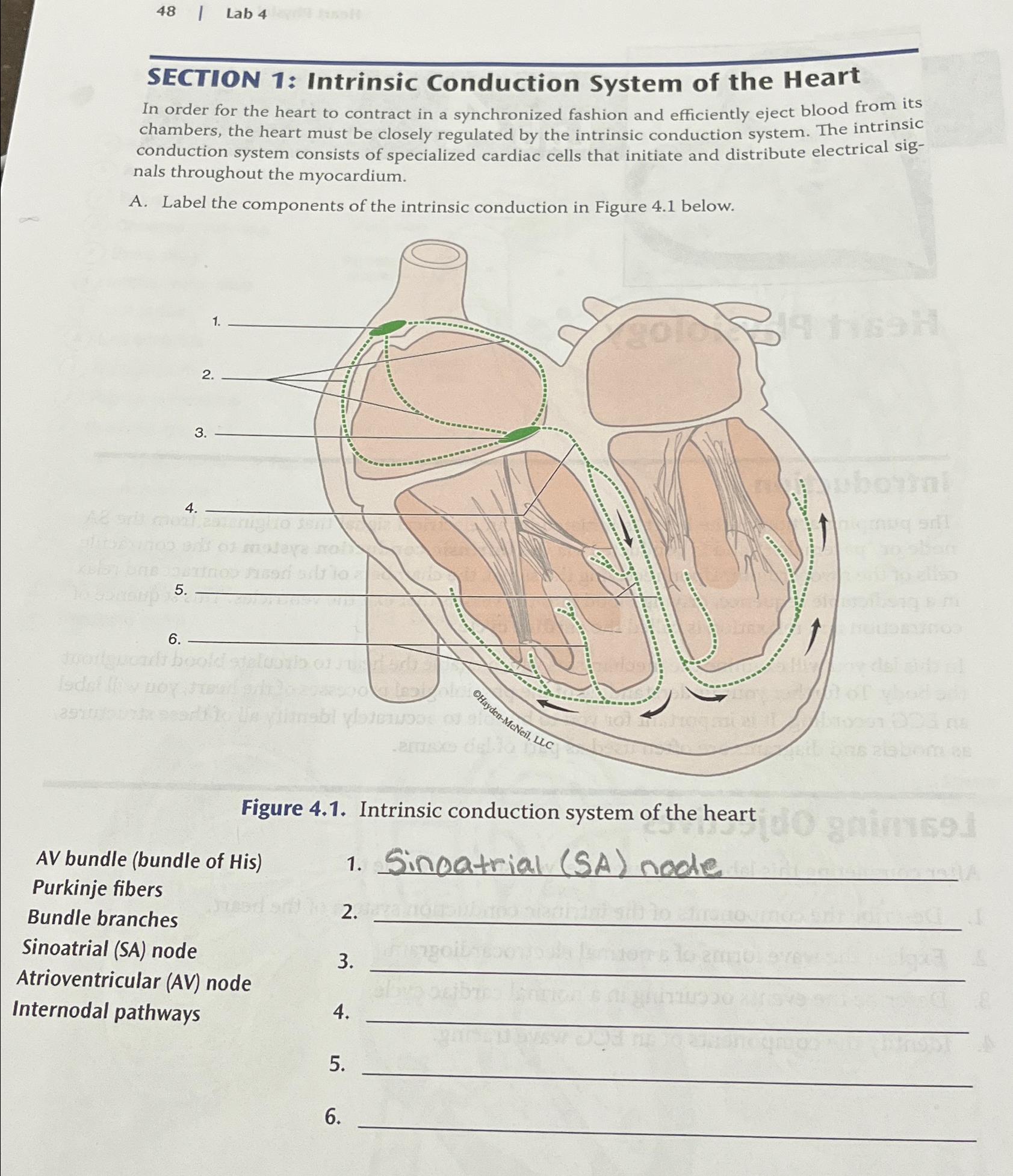 Solved 48Lab 4SECTION 1: Intrinsic Conduction System of the | Chegg.com