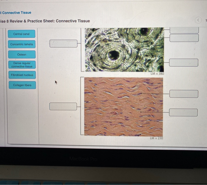 Solved Il Connective Tissue cise 8 Review & Practice Sheet: | Chegg.com