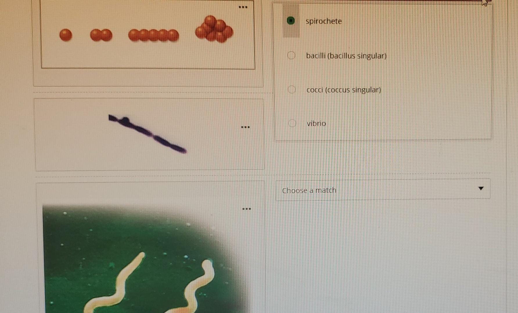 Solved ... spirochete bacilli (bacillus singular) o COCCI | Chegg.com