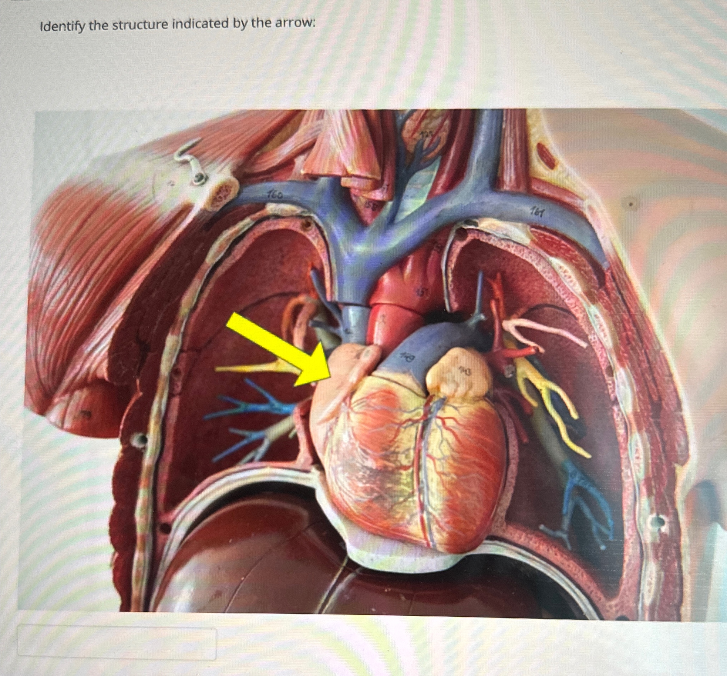 Solved Identify the structure indicated by the arrow: | Chegg.com