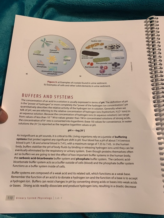 Microscopic Examination . Mucus - Strands of mucus | Chegg.com