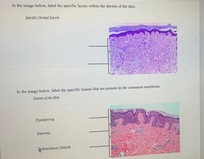 Solved In the image below, label the specific layers within | Chegg.com