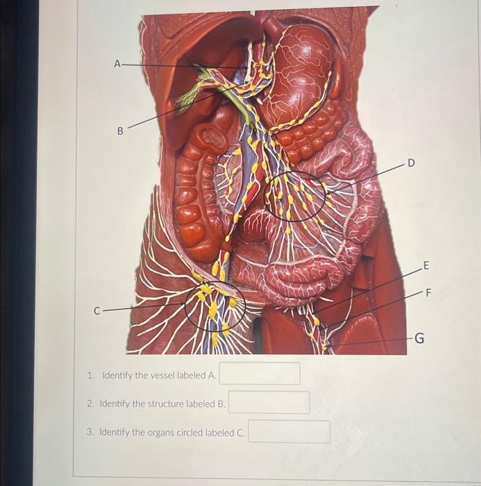 Solved 1. Identify the vessel labeled A. 2. Identify the | Chegg.com