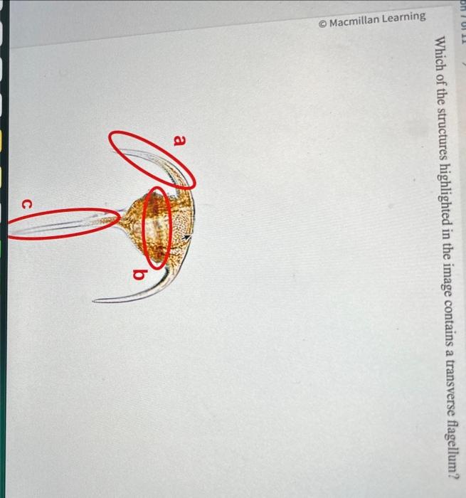 Solved Which of the structures highlighted in the image | Chegg.com
