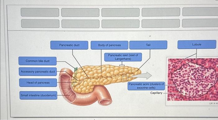 Solved Common bile duct Accessory pancreatic duct Head of | Chegg.com