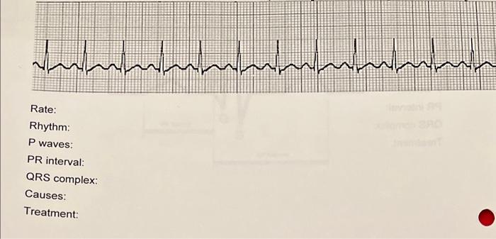 Solved Rate: Rhythm: P waves: PR interval: QRS complex: | Chegg.com