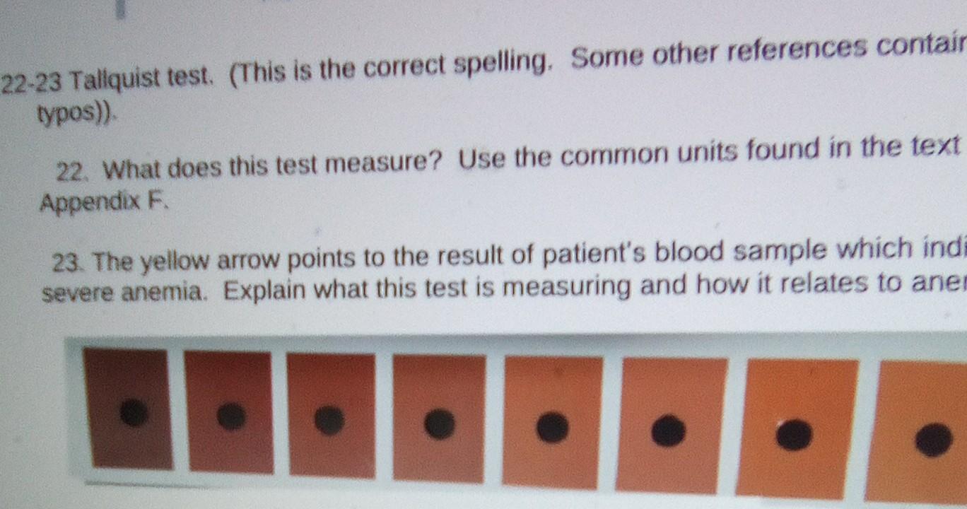 Solved 2-23 Taliquist test. (This is the correct spelling. | Chegg.com