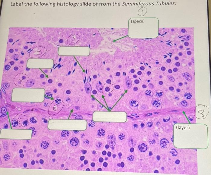 Solved Label the following histology slide of from the | Chegg.com