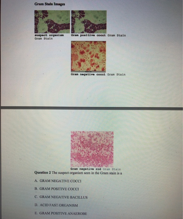Solved Gram Stain Images suspect organism Gran stain Gram | Chegg.com