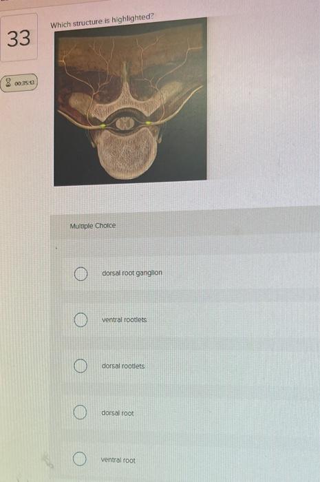 Solved Which structure is highlighted? 34 Multiple Choice | Chegg.com