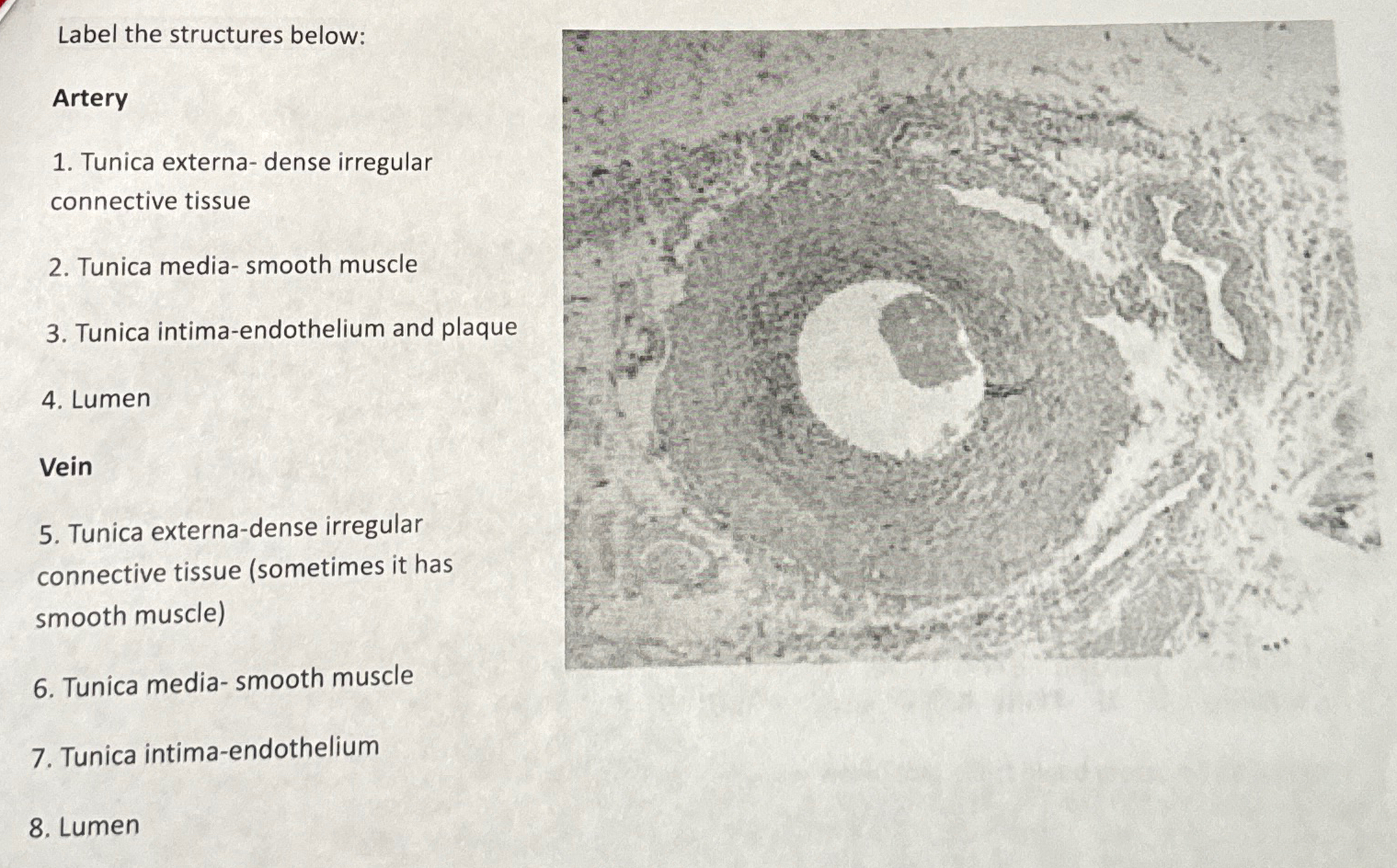 Solved Label the structures below:ArteryTunica externa- | Chegg.com