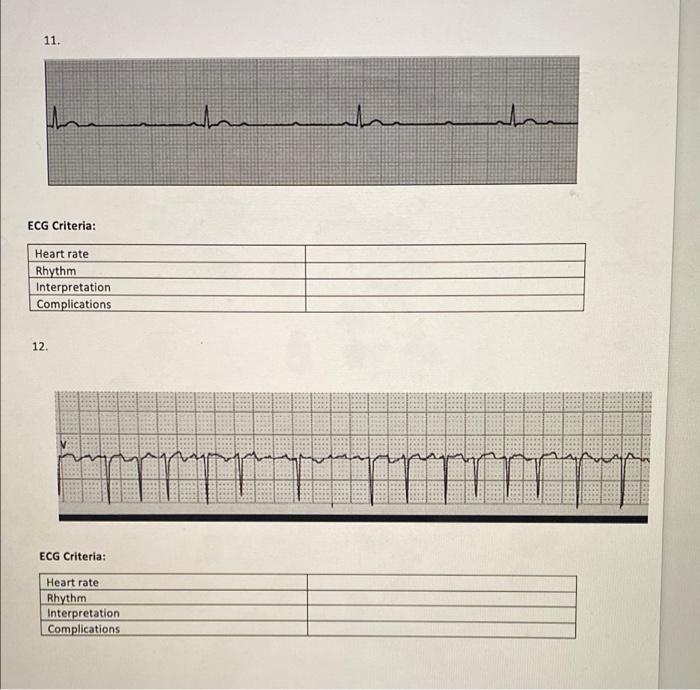 The following rhythm strips are for your practice. | Chegg.com