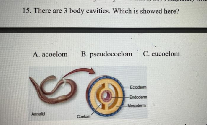 Solved 15. There are 3 body cavities. Which is showed here? | Chegg.com