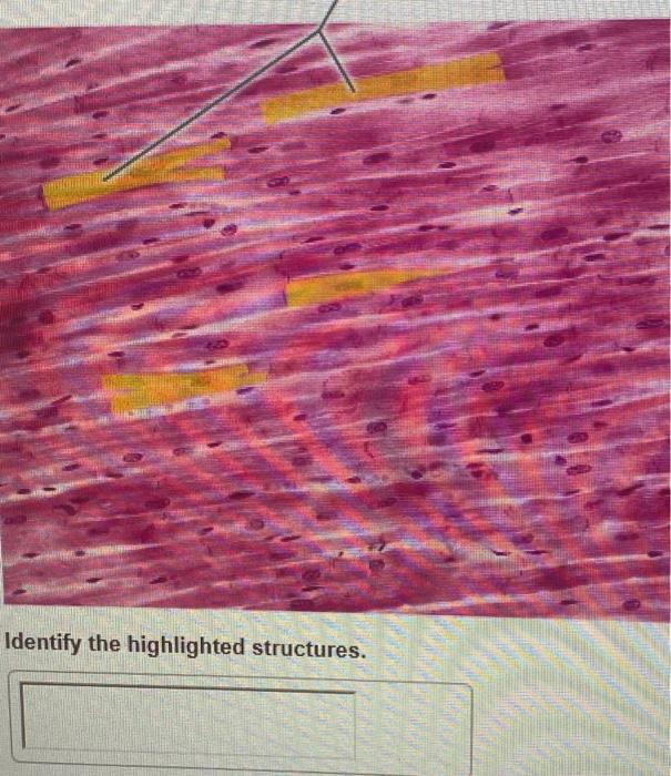 Solved Identify the highlighted structure. Identify the | Chegg.com
