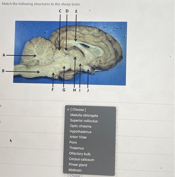 Solved Match the following structures to the brain. (letters | Chegg.com