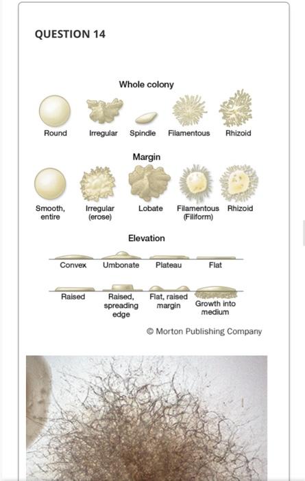 Solved QUESTION 14 Whole colony Elevation | Chegg.com