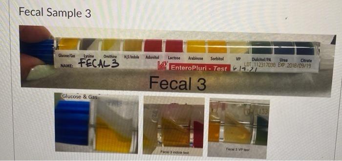 Fecal Sample 1: Fecal Sample 2 Fecal Samnle ? | Chegg.com