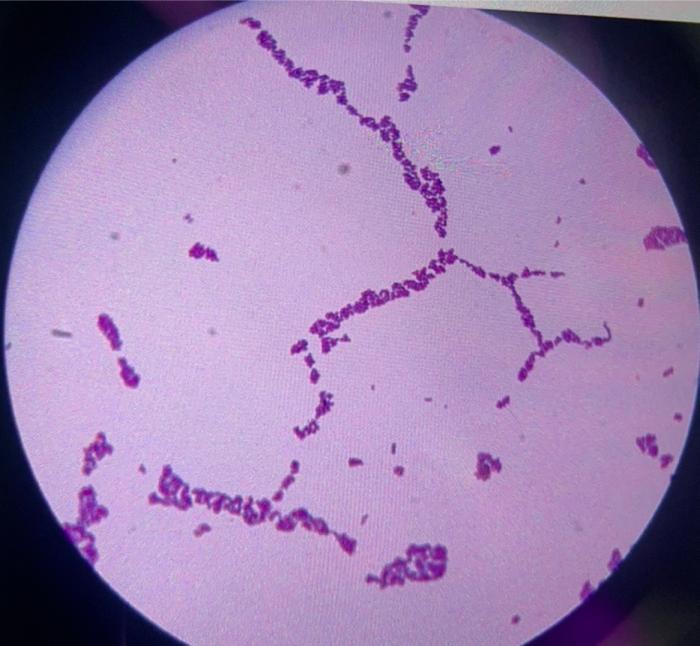 Solved from this gram stain, does it look like this | Chegg.com