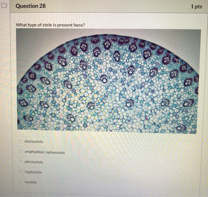 Solved Question 28 1 pts What type of stele is present here? | Chegg ...