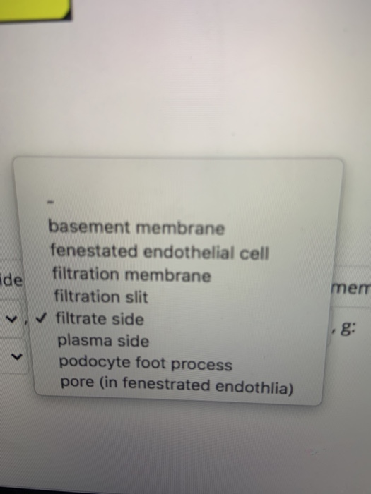 Solved A E F B С D G ide mem basement membrane fenestated | Chegg.com