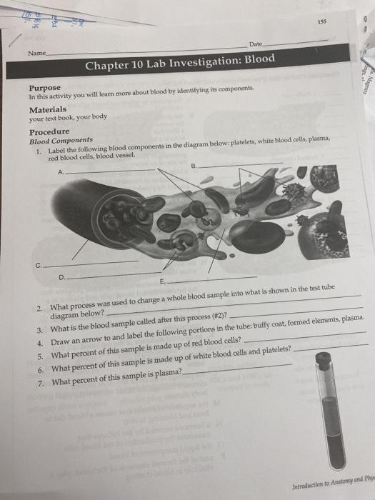 Solved 155 Date Name Chapter 10 Lab Investigation: Blood . | Chegg.com
