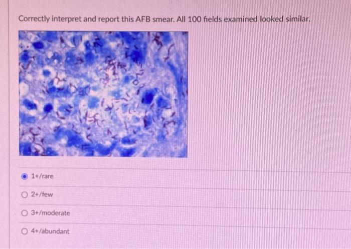 Solved Correctly interpret and report this AFB smear. All | Chegg.com