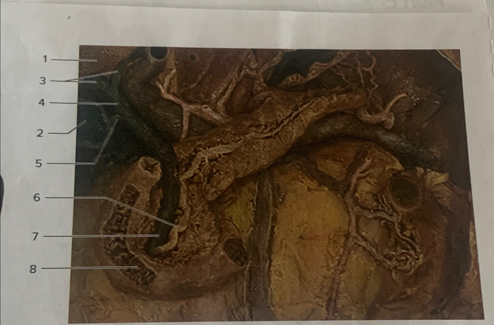 Solved Label the features associated with the liver and | Chegg.com