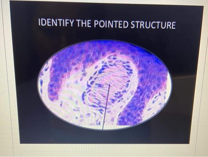 Solved IDENTIFY THE POINTED STRUCTURE | Chegg.com