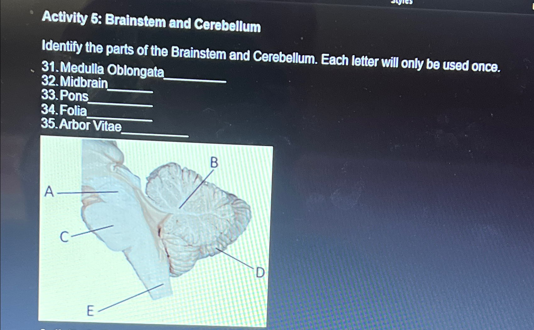 Solved Activity 5: Brainstem and CerebellumIdentify the | Chegg.com