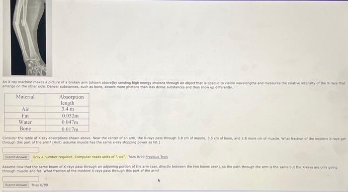 Solved An X-riy muchine makes a picturn of a broken amm | Chegg.com