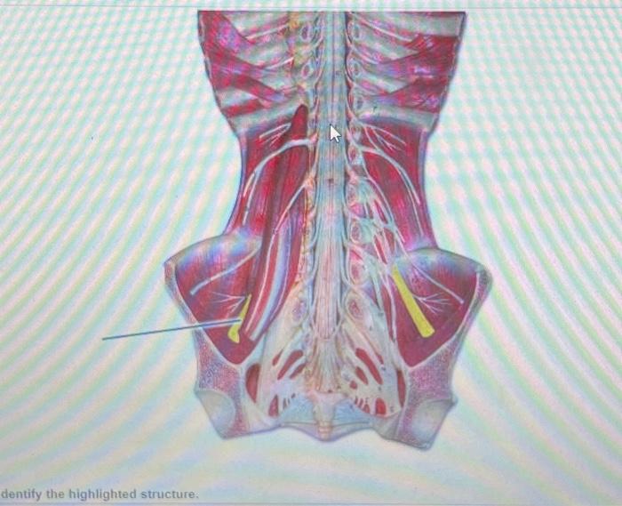 Solved dentify the highlighted structure. | Chegg.com Solved dentify the highlighted structure. | Chegg.com