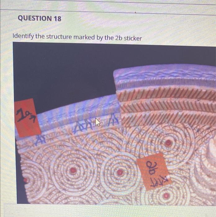 Solved QUESTION 18 Identify the structure marked by the 2b | Chegg.com