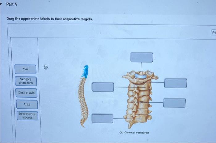 Solved Which part of a vertebra is known as the centrum? | Chegg.com