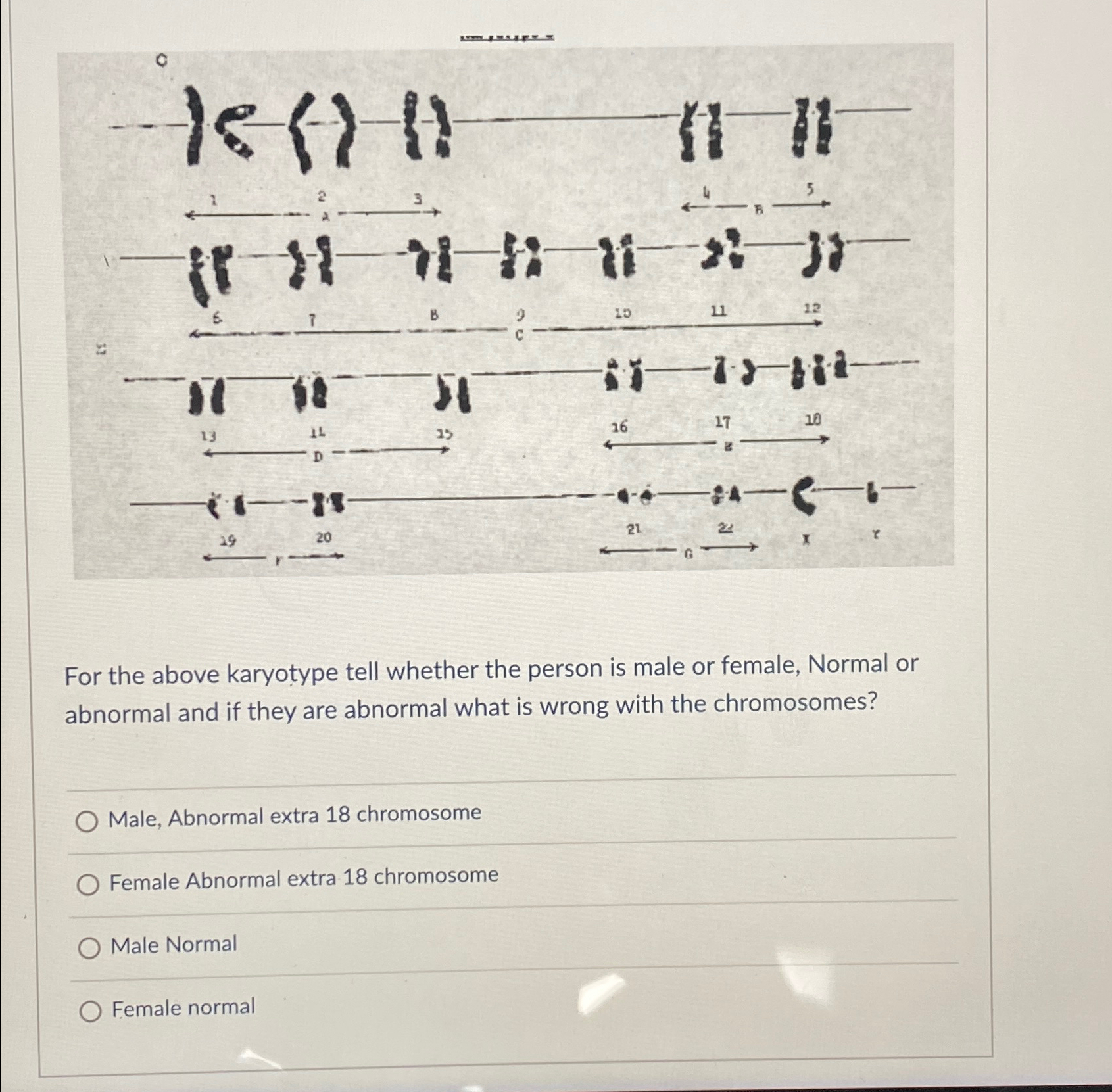 Solved For the above karyotype tell whether the person is | Chegg.com