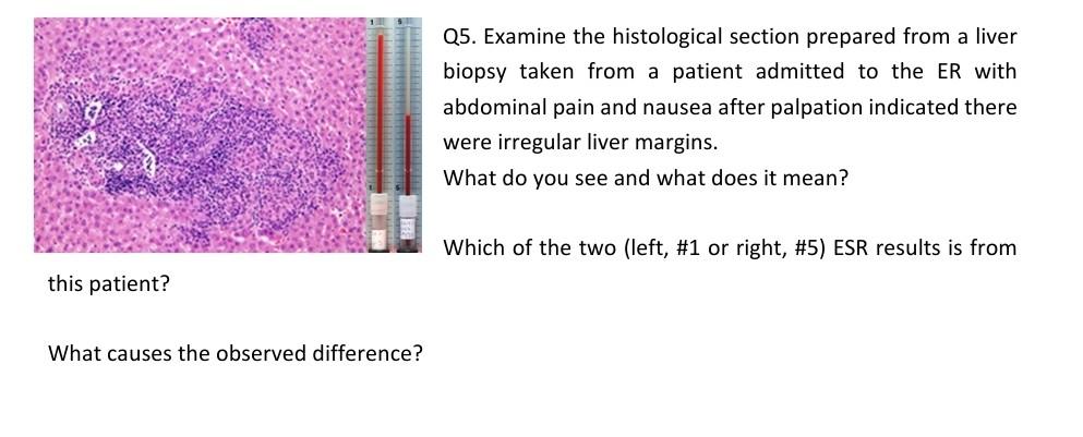 Solved Q5. Examine the histological section prepared from a | Chegg.com